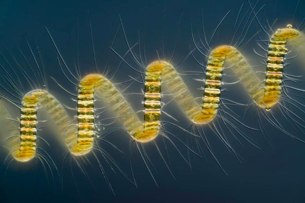 A Diatom Helix | Smithsonian Ocean
